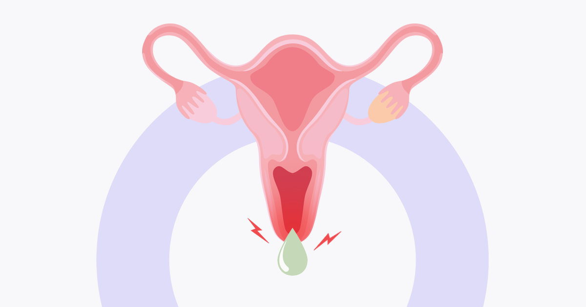 Vaginitis: Causes, Symptoms & Treatment Options | Ova SG